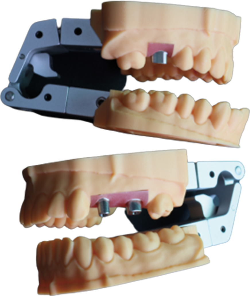 Implant Products - Bright Dental Lab