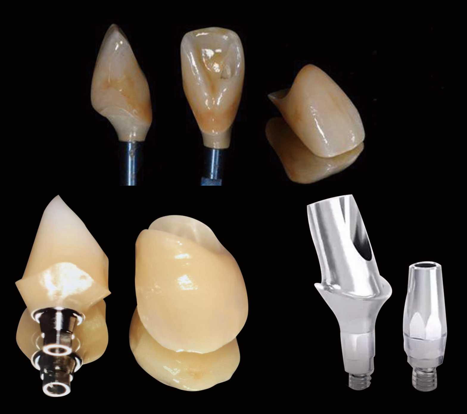 Implant Products - Bright Dental Lab