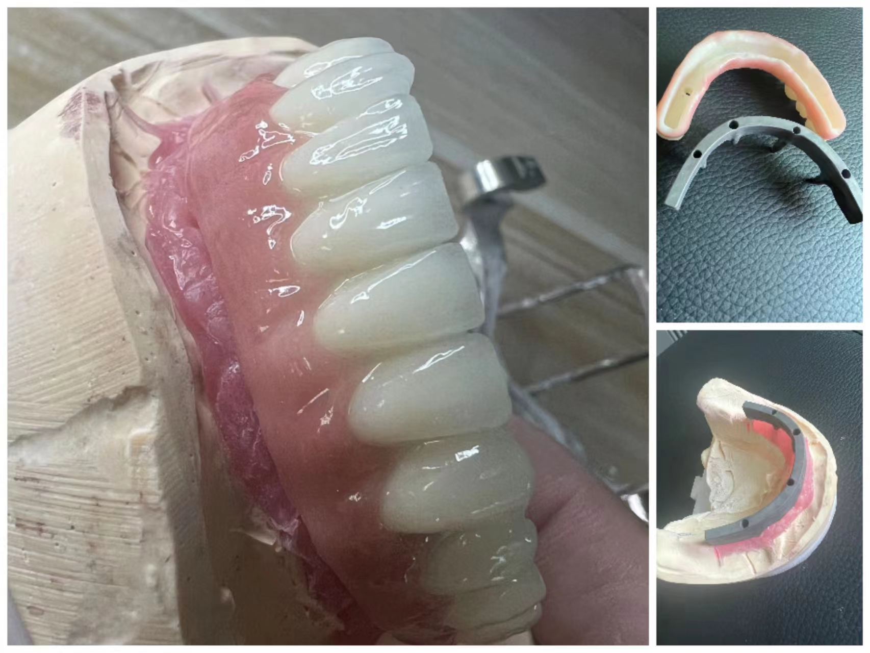 Implant Products - Bright Dental Lab